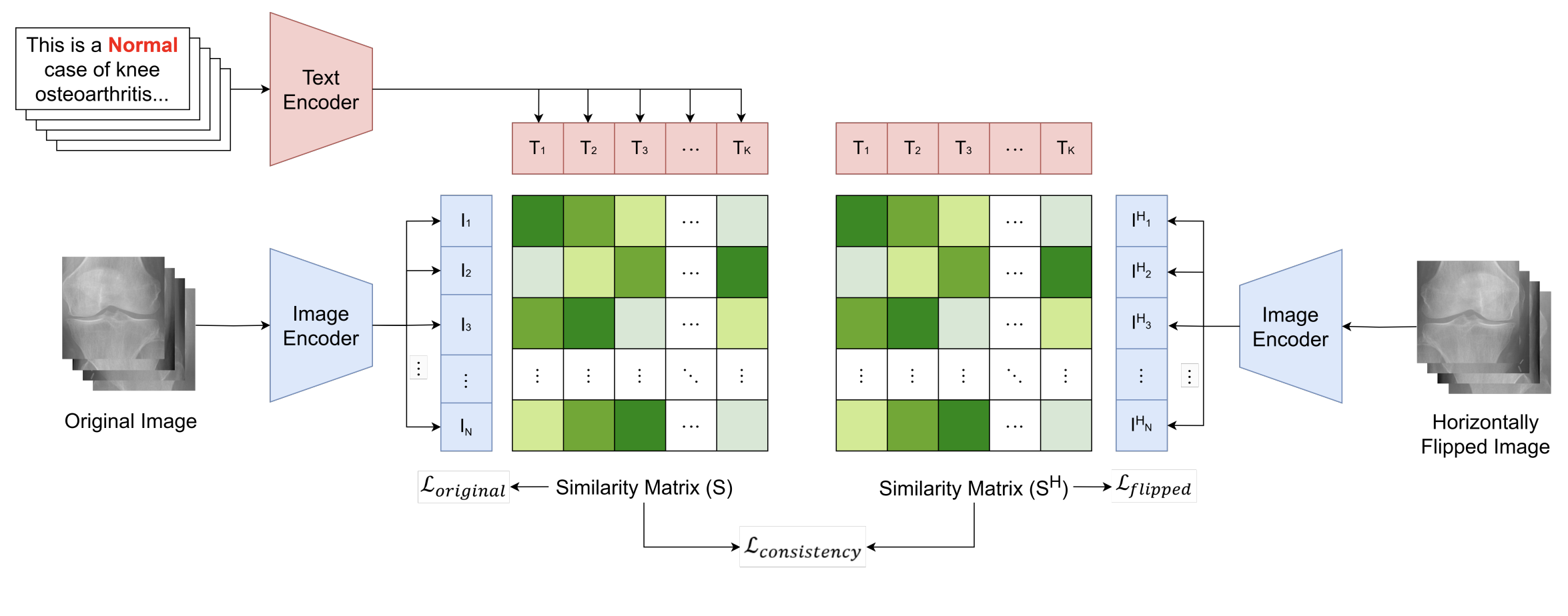 CLIP-KOA: Enhancing Knee Osteoarthritis Diagnosis with Multi-Modal Learning and Symmetry-Aware ...